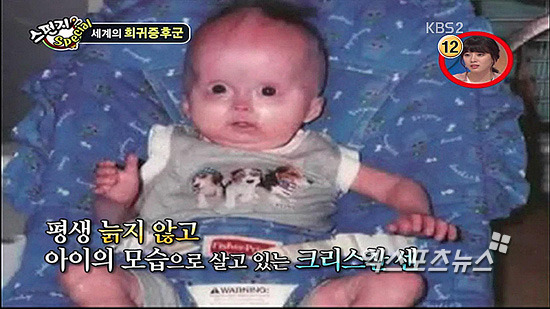 하이랜더 증후군 평생 늙지 않아 실제로 가능