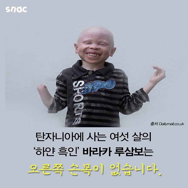 카드뉴스 주술사를 무찌를 의사가 되겠다는 알비노 흑인 소년