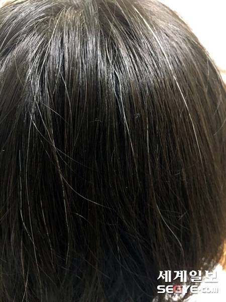 [김기자와 만납시다] 젊은 내 머리의 스크래치..'앗, 새치!'