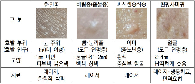 여드름도 아니고좁쌀같은 발진 이게 뭐지