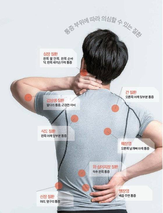 근육통의 놀라운 신호왼팔 아프면 심장 옆구리 통증땐 콩팥