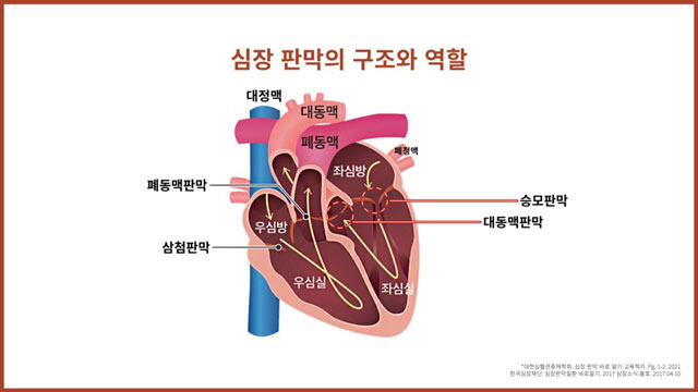 심장의 문 판막 오래 쓰면 닳아 이상 증상 알아두세요