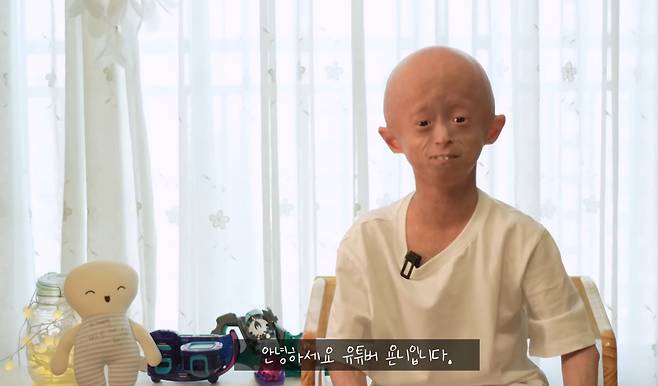 더쿠 20살이 최대 수명‘조로증 원기 우리 오늘을 살아요”