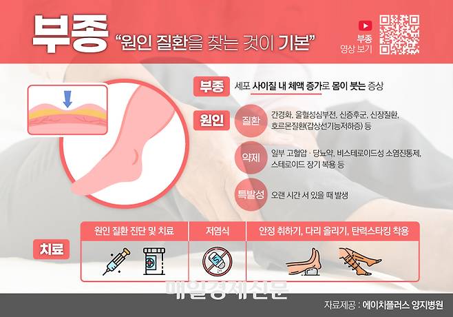 언론사뷰