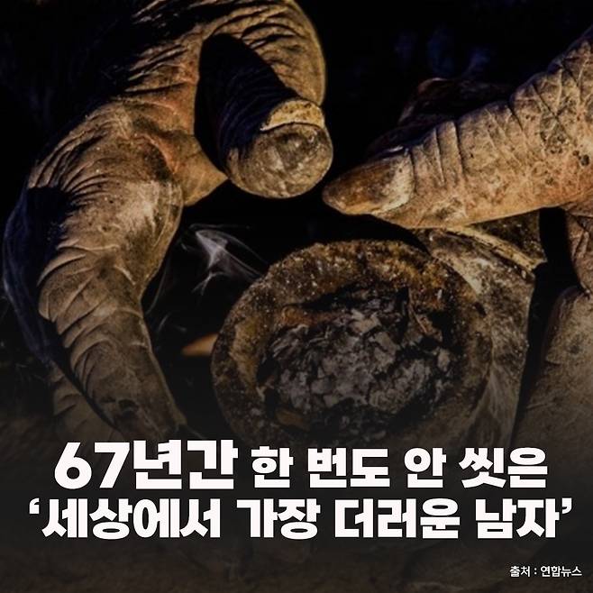 67년간 한 번도 안 씻은 ‘더러운 남자 목욕 후 결국 1일 1교양