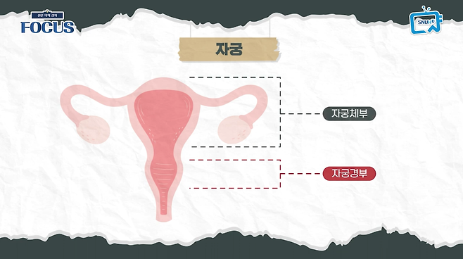 자궁암 중요 의심 증상과 치료 임신 가능한 경우는 서울대학교병원