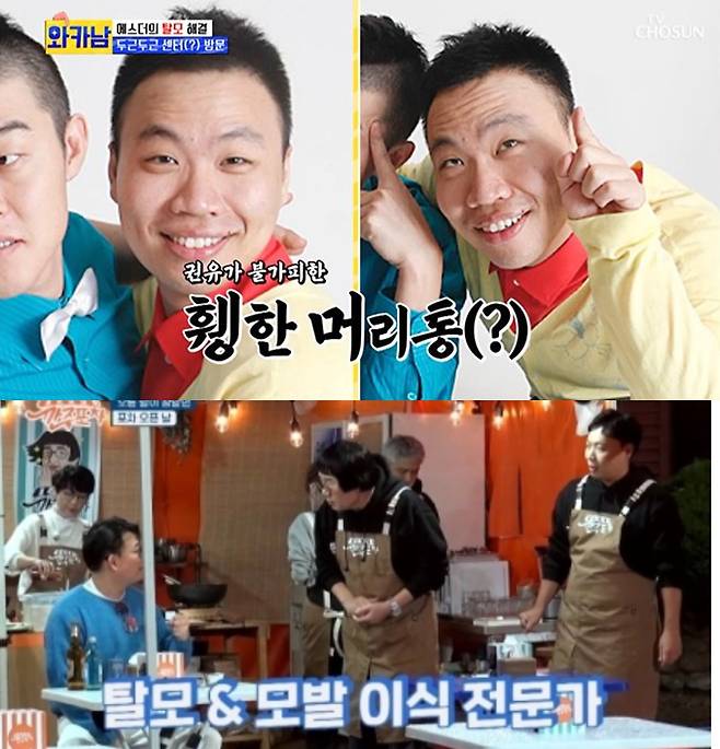 휑해서 2500모 심었다 개그맨 이상준 모발이식 성공적