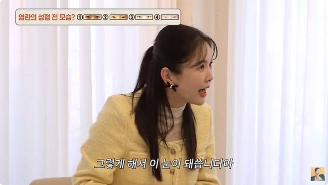 장영란 성형 전 모습 공개 눈만 3번 앞트임 1번 뒷트임 1번 그 눈이 이 눈이 됐다”