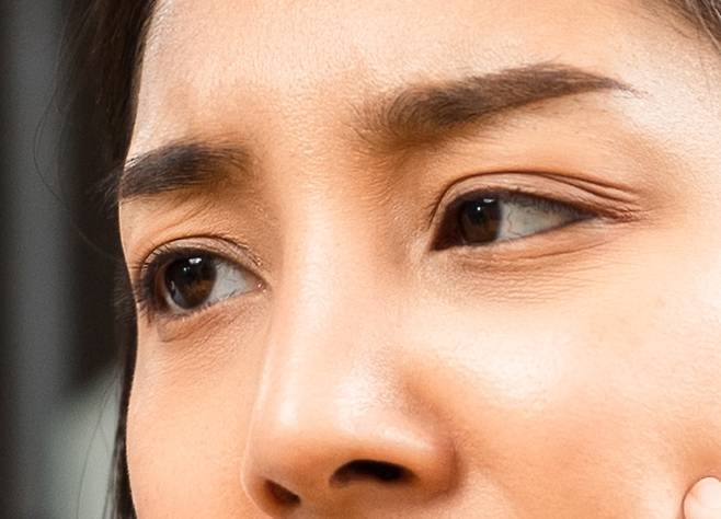 눈 밑에 자리 잡은 검은 그림자 ‘다크서클이 아닐 수도 있다