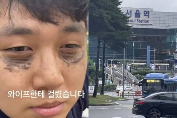 ‘기부 공약 내걸었다 서울역 나앉은 Lg전자 직원 회사가 지원한다