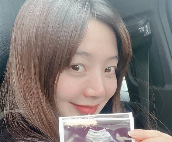 6년열애끝에 결혼♥하더니 한달만에 임신한 커플득녀소식 어썸클