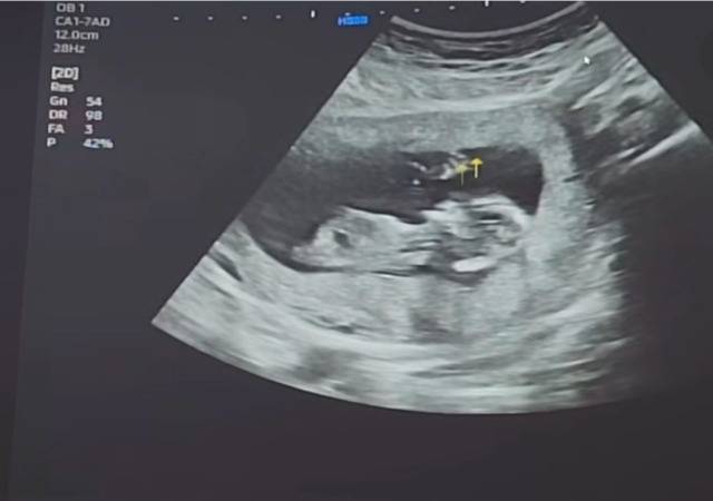 결혼 6년만에 드디어 임신발표한 33세 여가수경사 어썸클