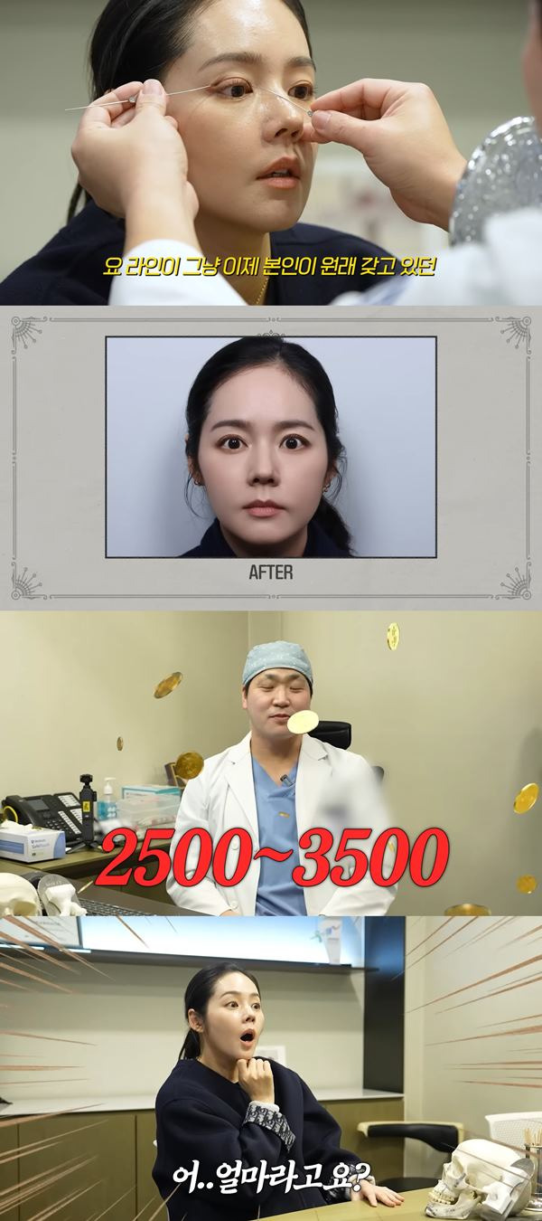 국보급 미녀도 성형 고민 한가인 성형 견적 차 한 대 값