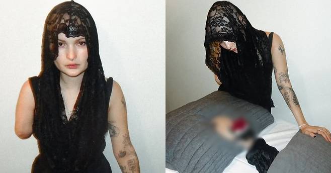 널 그리워할 거야” 절단한 오른팔 장례식 연 22살 여성 화제