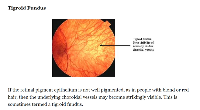 시력 저하의 전조? 범무늬 안저, 알고 나면 무서운 망막 이야기 | 웰니스로그